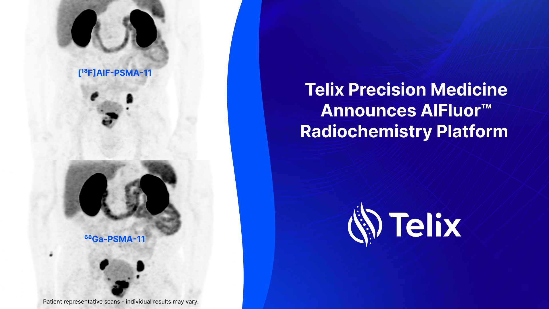 Telix Precision Medicine Announces AlFluor™ Radiochemistry Platform ...
